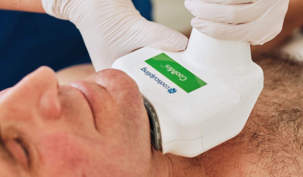 Coolsculpting - Double Chin Reduction | Hill Street Clinic